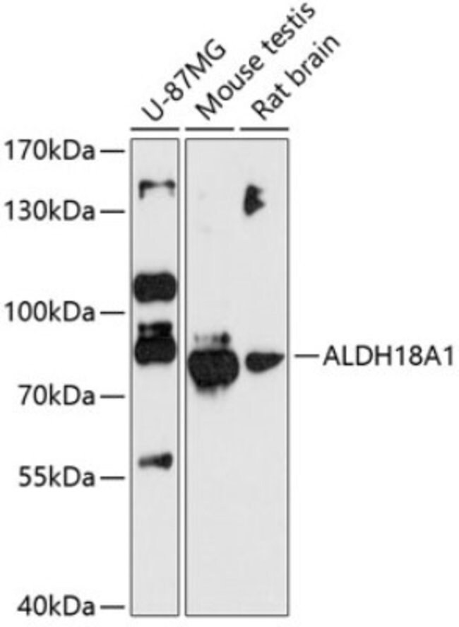 ALDH18A1 Rabbit anti-Human, Mouse, Rat, Polyclonal, Novus Biologicals 20 | Fisher Scientific